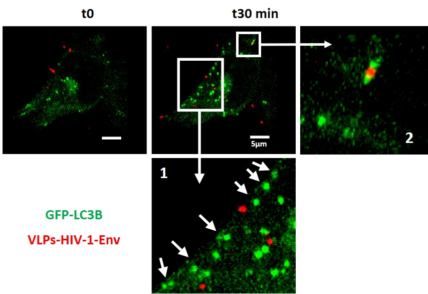 LC3B conjugation machinery promotes autophagy-independent HIV-1 entry ...